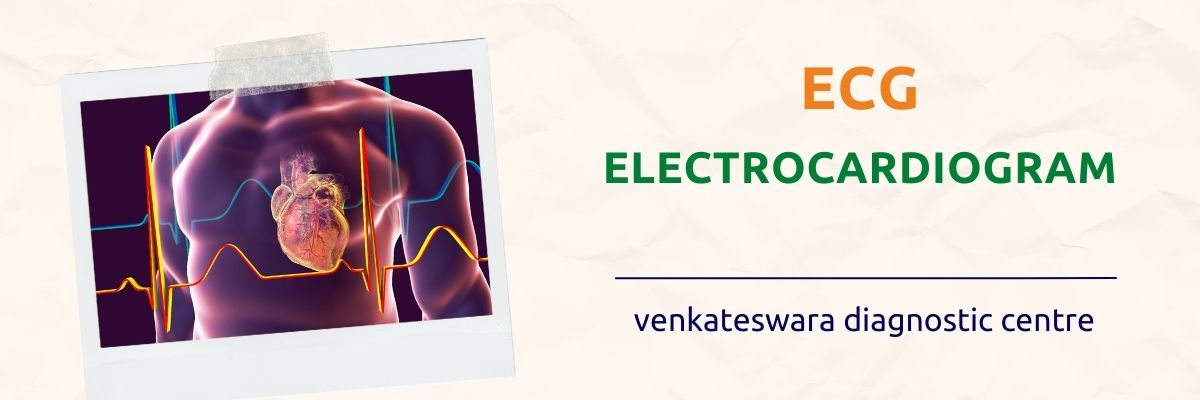 ECG - venkateswara diagnostic